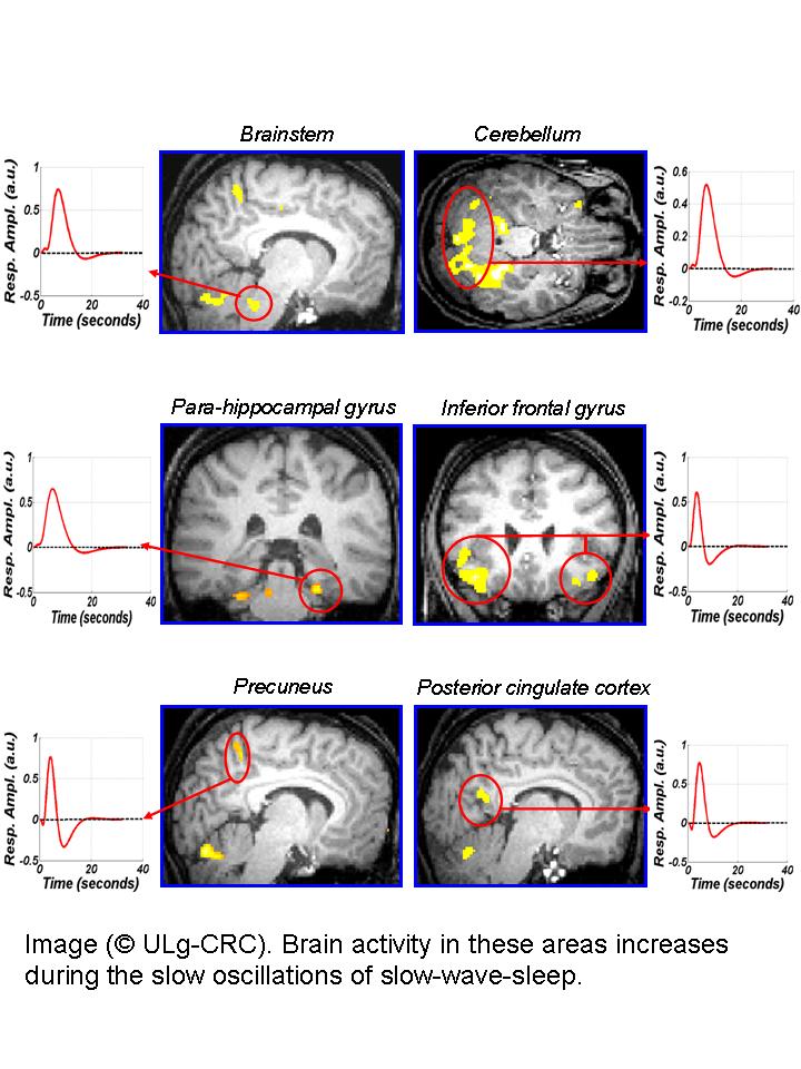 Even When You Sleep, Your Brain Is Awake | Science 2.0