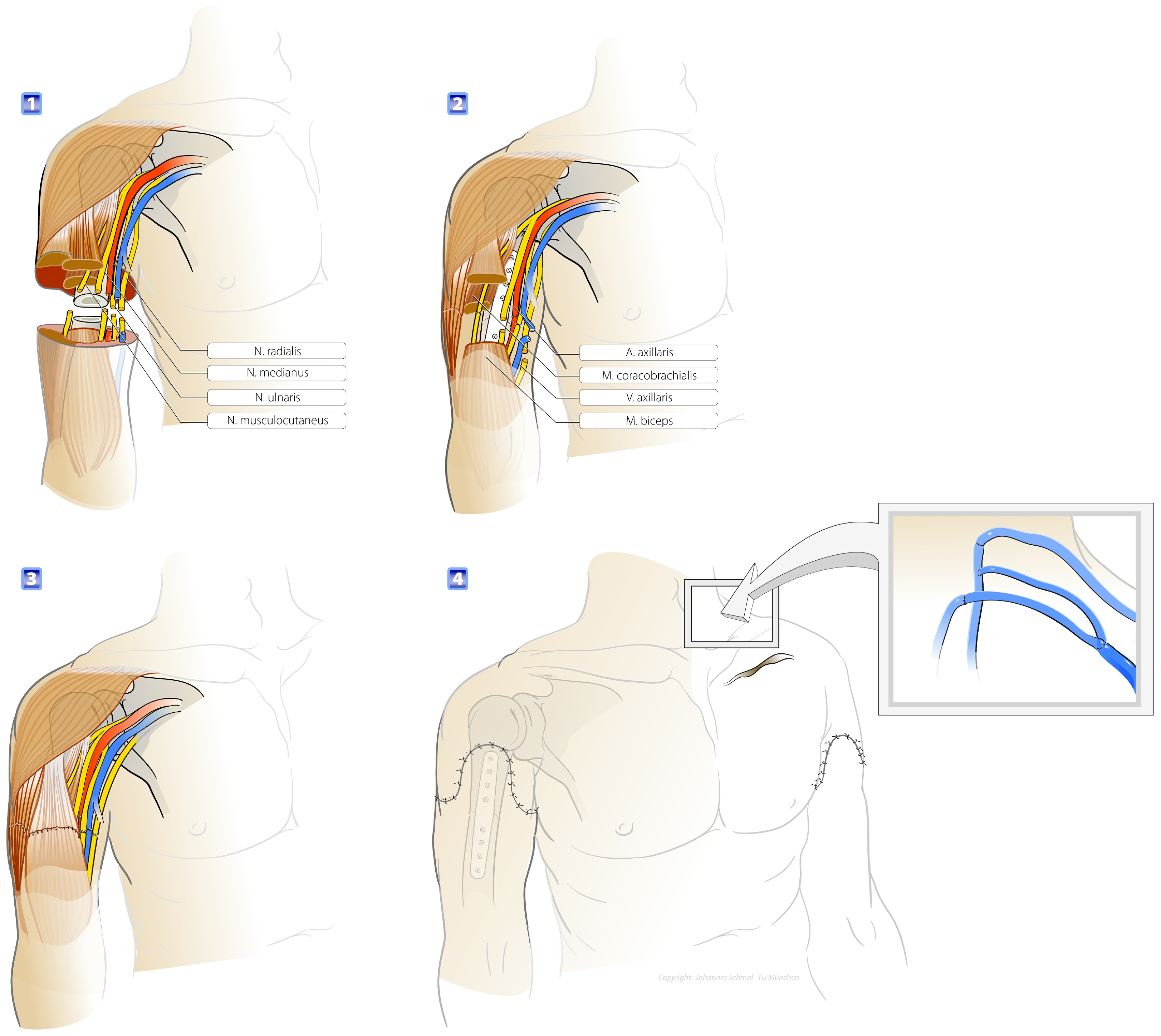 Case History Of The Farmer Who Had A Double Arm Transplant | Science 2.0