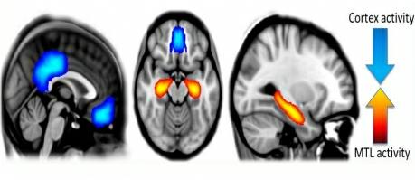 Dream State And Lower Sense Of Self - Psychedelic Drugs Get A Science ...