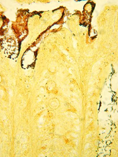 Sometimes Good Gut Bacteria Get Sick | Science 2.0