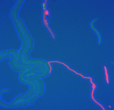 Predator And Prey - But These Bacteria Control Each Other's Suicides ...